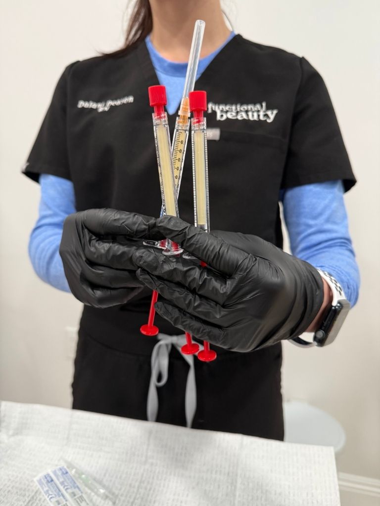 PRF Gel Treatments in Ventura & Moorpark | Natural Skin Rejuvenation ...